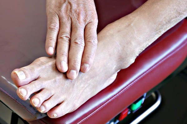 Foot Problems Arthritis Treatment - Island Foot Clinics